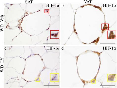 Decrease In Hif 1α Expression And Nuclear Translocation In Macrophages