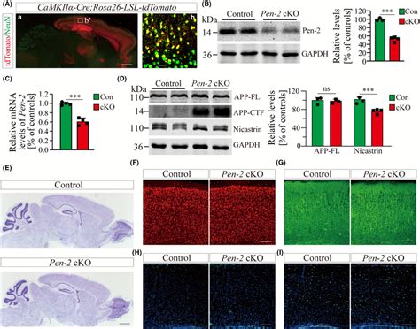 Molecular Characterization Of Forebrain Neuron‐specific Pen‐2 Cko Mice