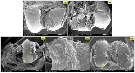 A E Scanning Electron Photomicrographs Of Articular Cartilage Of Rats