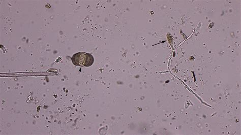 Pollen Archives EClinpath