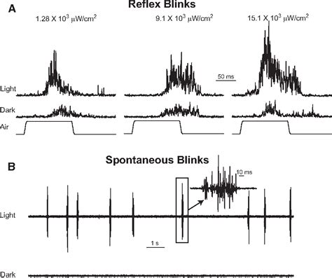 Figure 1 From Light Induced Trigeminal Sensitization Without Central