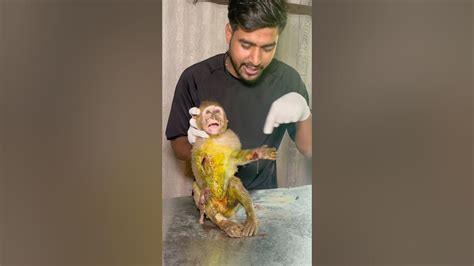 करंट की वजह से दोनों हाथ जल गया है और इसका हड्डी दिखाई दे रहा है चेहरा