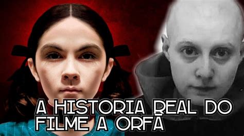 A Verdadeira Historia Da Orf
