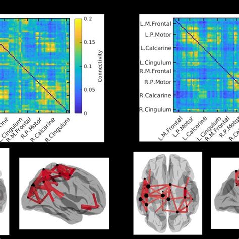 Resting State Connectivity Plots Derived From Opm Data Alpha A And