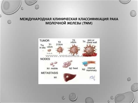 Заболевания молочной железы презентация онлайн