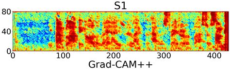 Reliable Visualization For Deep Speaker Recognition