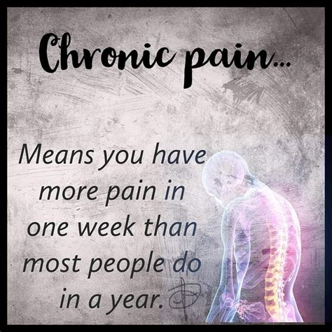 Migraine And Trigeminal Neuralgia Is There A Link Artofit