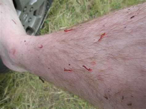 Red Worms Crawling Out Of My Skin After A Session General Discussion