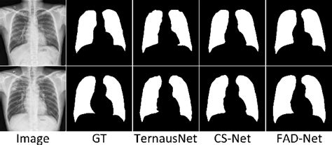 figure 5 from a real time multi task framework for guidewire segmentation and endpoint
