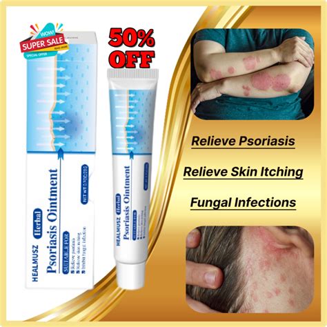 Psoriasis Ointment Herbal Antibacterial For Skin Psoriasis Cream