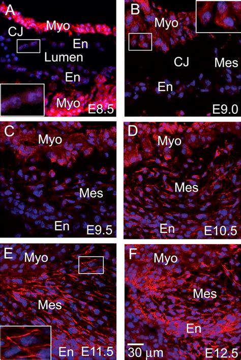Spatiotemporal Localization Of Leptin During Endocardial Cushion Download Scientific Diagram