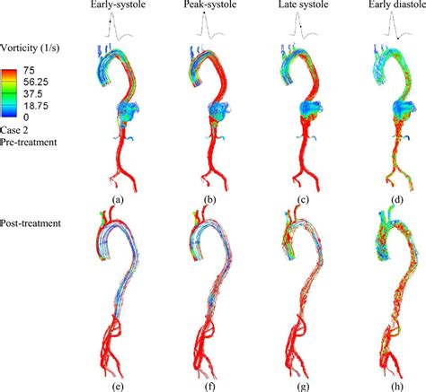 Instantaneous Vorticity Plots Were Generated At Four Representative