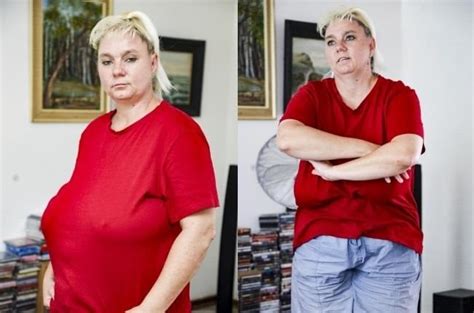 I Had Breast Reduction Surgery But Now My Breasts Are Even Bigger Than