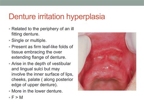 Hyperplasia PPTX Dental Health Diseases And Conditions