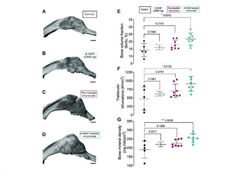 Micro Computed Tomography μct Analysis Of Newly Formed Bone Within