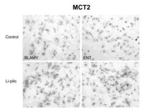 Mct2 Mrna Expression In Basolateral Amygdala And Entorhinal Cortex Of Download Scientific