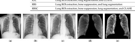 Figure 7 From Deep Learning Based Classification And Semantic Segmentation Of Lung Tuberculosis