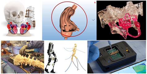 Ecs 3d Printing Capabilities For Healthcare