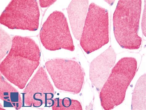 Ihc Plus™ Emcn Endomucin Polyclonal Antibody Rabbit Ihcwb Lsbio