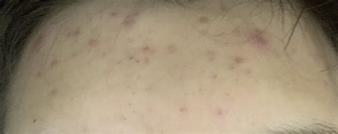 Routine Help Anything I Need To Add Remove Change R SkincareAddiction