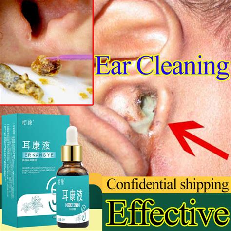 Acute Otitis Ear Drops Natural Chinese Herbal 20ml 100 Original Tinnitus Ear Drops Healthy Care