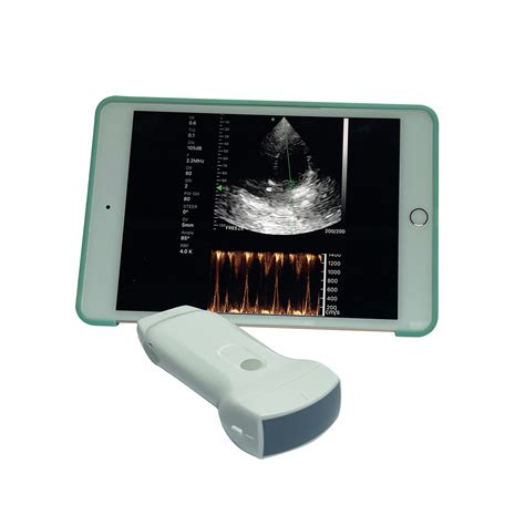wireless android ultrasound probe wifi usb ultrasound convex linear