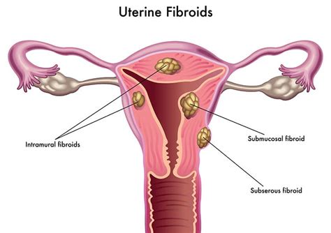 Uterine Layers