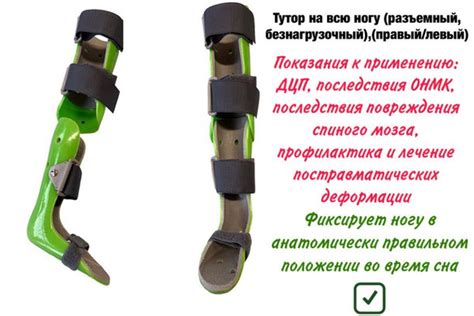 ОГОНЕК Тутор на всю ногу разъемный безнагрузочный ночной, 14 правый ...