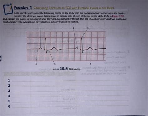 Solved Procedure 1 Correlating Points On An Ecg With