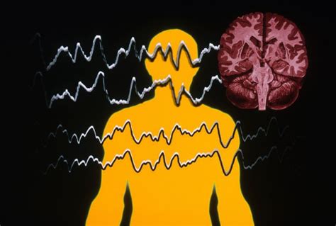 Implantable Brain Device Could Stop Epileptic Seizures In Their Tracks Ars Technica