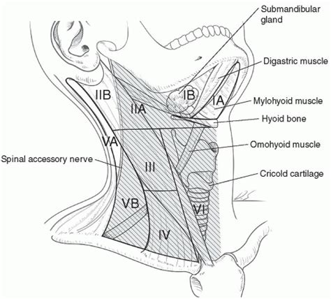 Robotic Modified Radical Neck Dissection For Thyroid Cancer Surgical