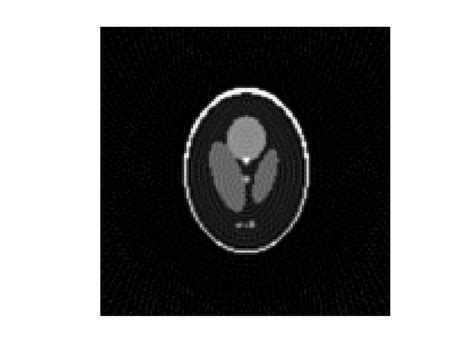 A Note On The Iterative MRI Reconstruction From Nonuniform K Space Data