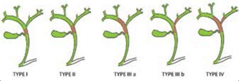 Hilar Cholangiocarcinoma Cross Sectional Evaluation Of Disease Spectrum Pmc