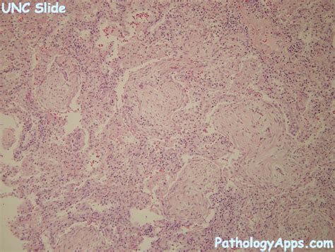 Dad Pathology