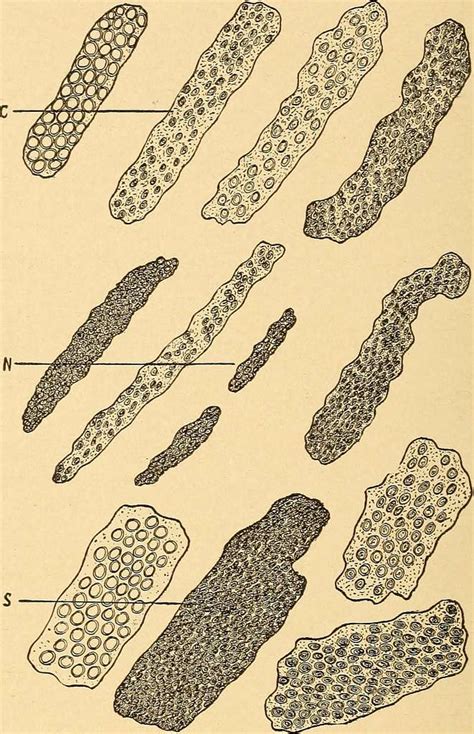 Urinary Analysis And Diagnosis By Microscopical And Chemical