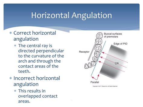 Chapter Bitewing Technique Ppt Dental Health Diseases And Conditions