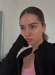 Sáng Da Giảm Mụn Hiệu Quả Kép Từ Dioic Acid Cho Làn Da Nhạy Cảm