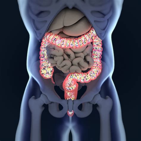 7 semne că suferi de sindromul intestinului permeabil