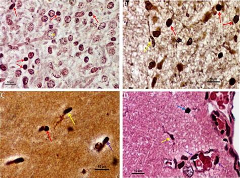 Microglial Cells Histology