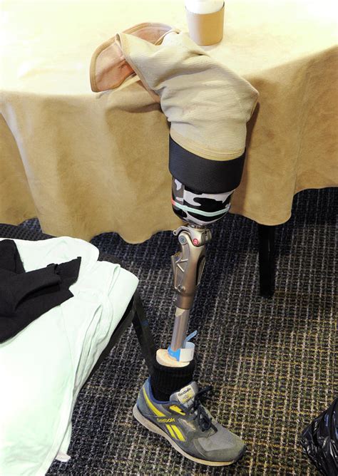 Prosthetic Leg Photograph By Public Health England