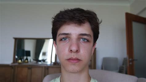 16 17 1 Year Progress I Had 4 Premolar Extractions And Braces R Mewing