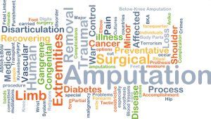 Is Amputation For CRPS Really A Cure Burning Nights