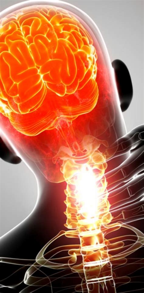 Post Whiplash Headache Causes And Treatment