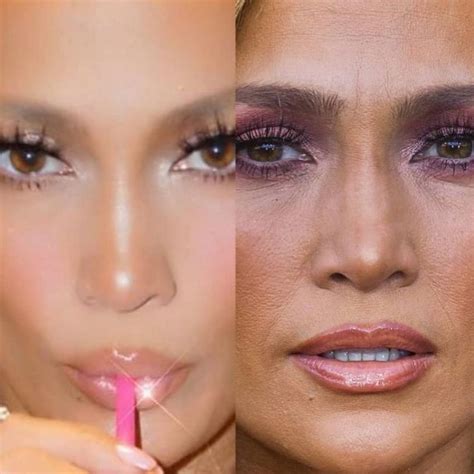 Plastic Surgeon Reveals Before And After Celebrity Photos