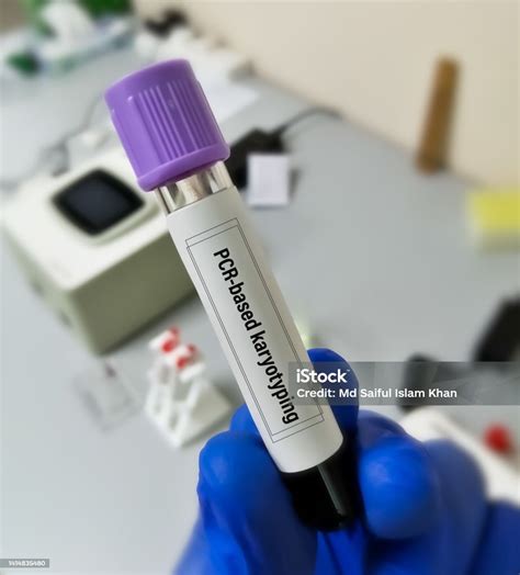 Pcr 기반 핵형 검사를 위한 혈액 샘플 유전 장애 염색체 분석 Dna에 대한 스톡 사진 및 기타 이미지 Dna Stem