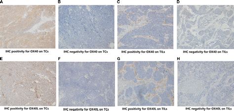 Frontiers Immune Checkpoints Ox40 And Ox40l In Small Cell Lung Cancer