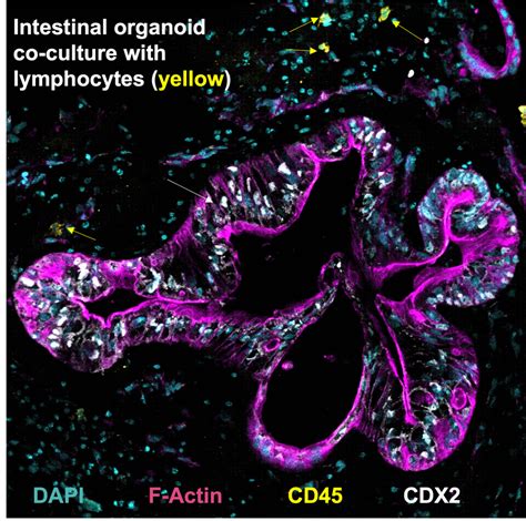 The Role Of The Intestinal Epithelium In Immune Responses To Food Allergens MRC DTP