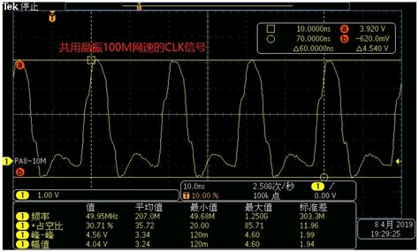 Dp83848i Dp83848i Clock Timing Requirement Interface Forum