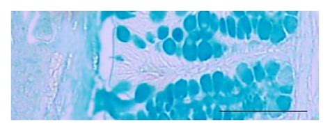 Histological Profiles Of The Fecal Pellet Containing Colons Of