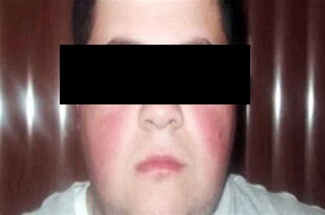 Luego De El Jamón Ahora Detienen A El Tomate Presunto Sicario De